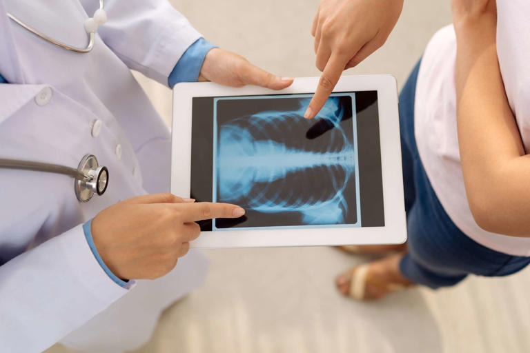 Why do my ribs hurt? 23 causes of rib cage pain
