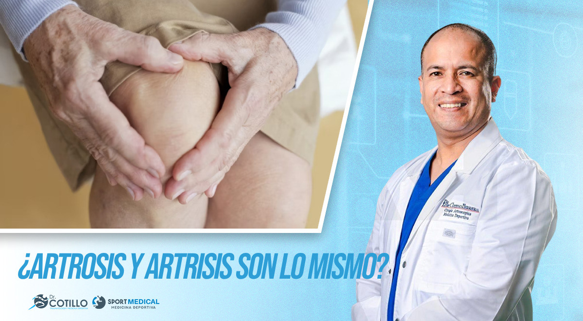 ¿Artrosis y artritis es lo mismo?, por el Dr. Luis Cotillo ¿Artrosis y artritis es lo mismo?, por el Dr. Luis Cotillo