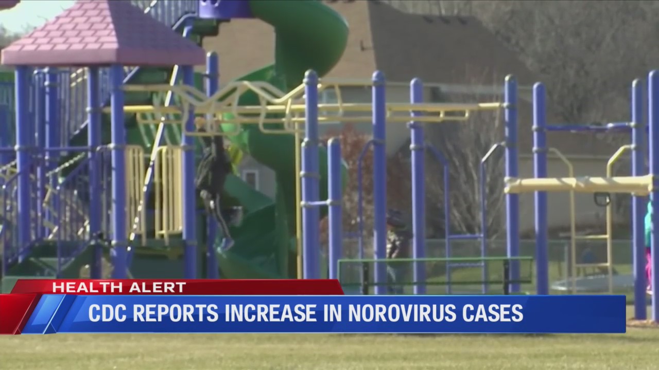 CDC reports increase in norovirus cases