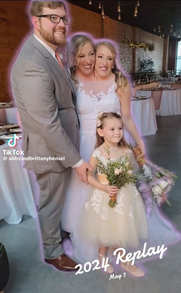 What to Know About Conjoined Twins Abby Hensel & Brittany Hensel