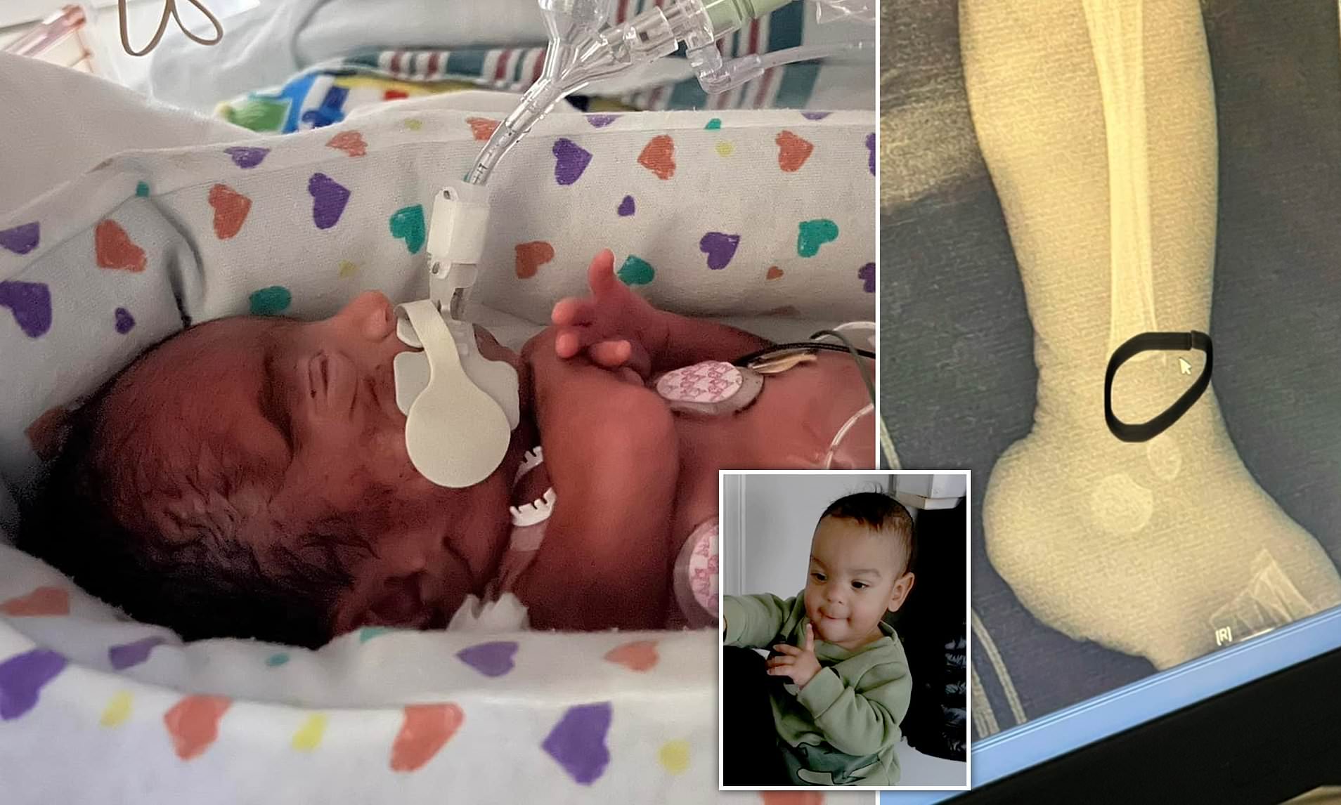 Frantic hunt for 'abuser' breaking babies bones at Virginia hospital