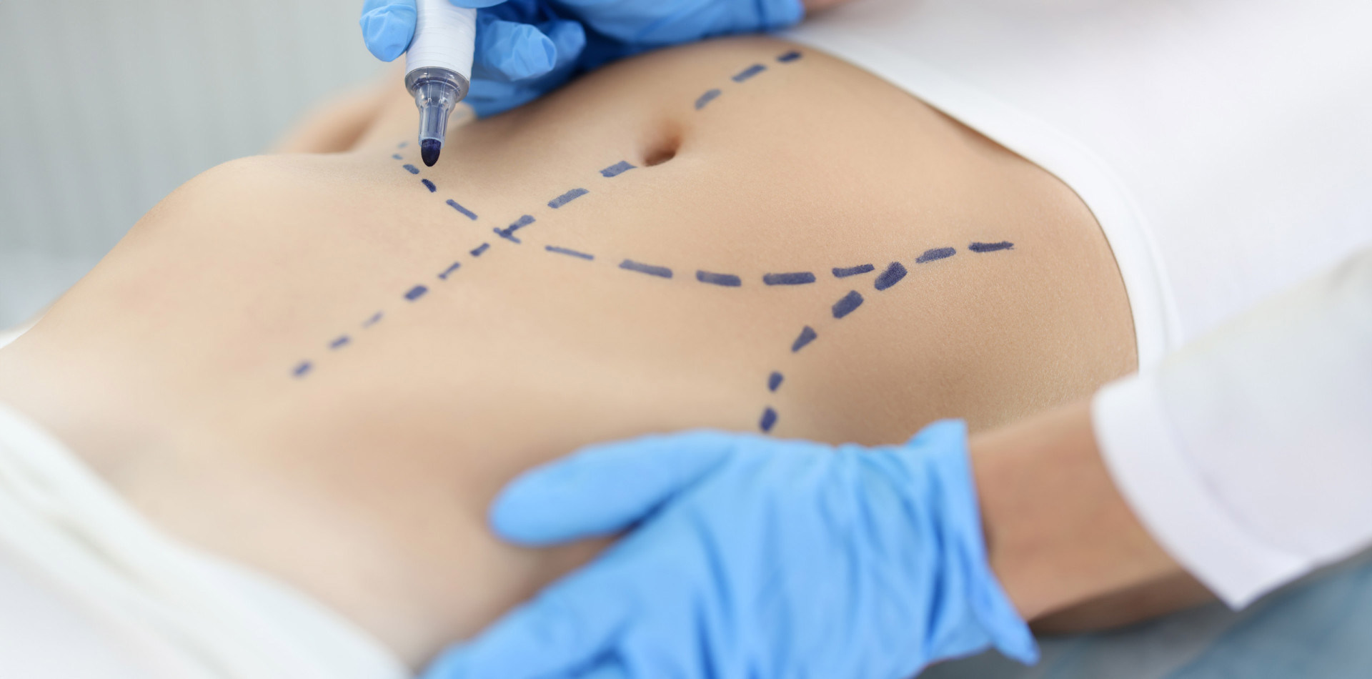 The world’s most popular plastic surgery procedures The world’s most popular plastic surgery procedures