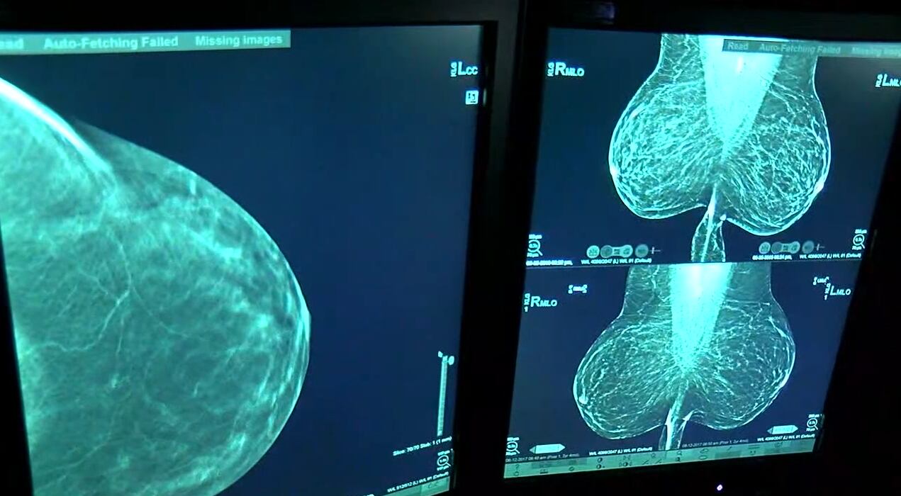 Medwatch: LCHC gets patients back on track with cancer screenings