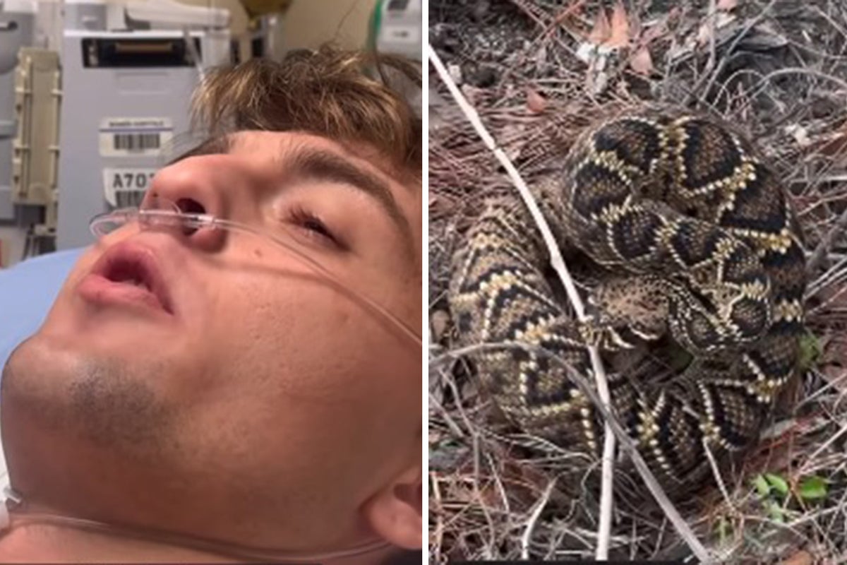 Snake-chasing social media star hospitalized after being bitten by ...