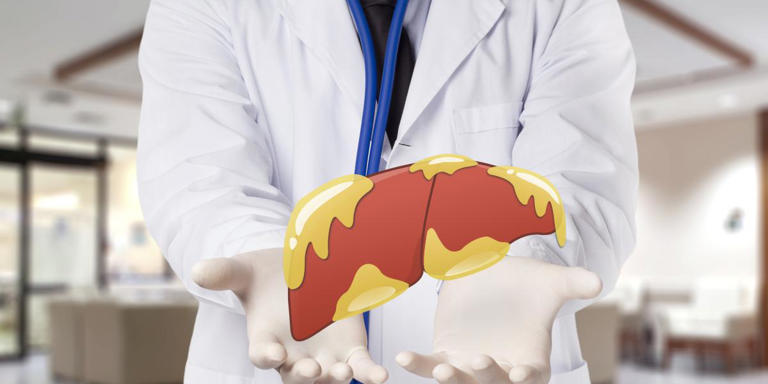 Hígado sano: las 13 estrategias comprobadas y recomendadas por la AASLD ...