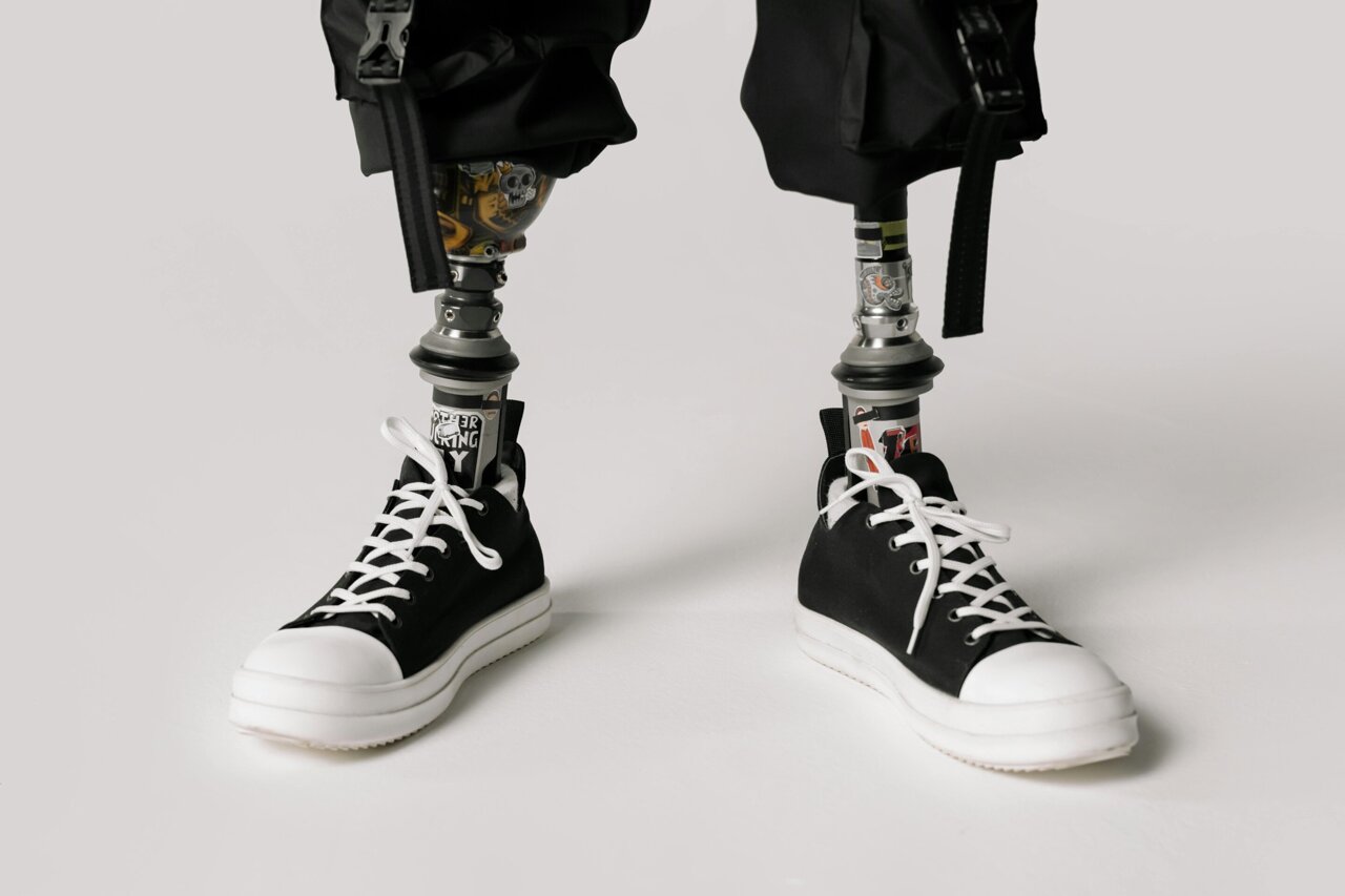 Scientists have been wrong about phantom limbs for decades