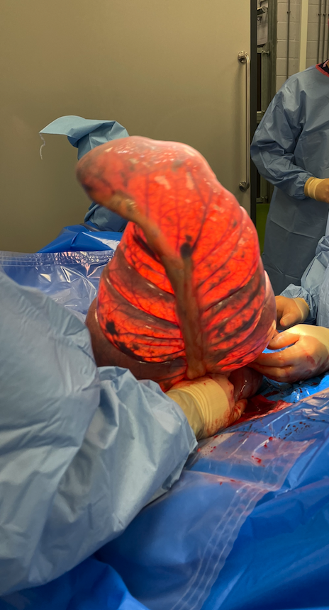 Impaction and gassy colic in horses explained by a vet