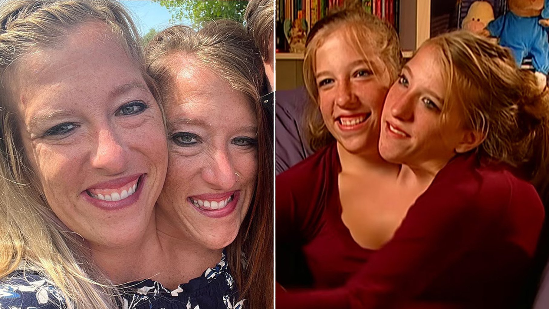 Conjoined twin sisters finally reveal how their bodies are really connected