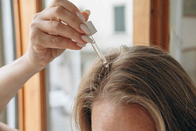 11 home remedies to try for dry scalp