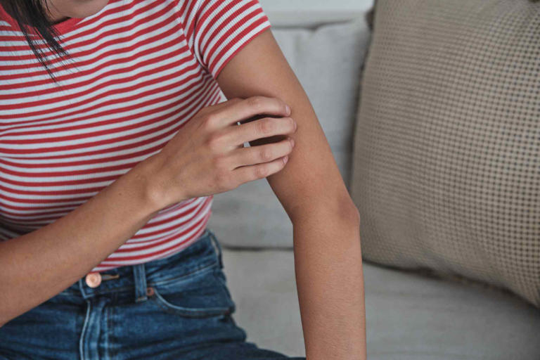 Dermatitis Types and Treatment Options