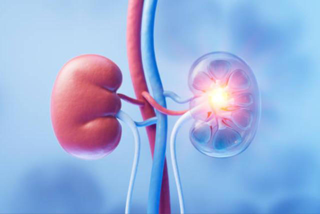 Enfermedad renal crónica: los factores de riesgo de esta afección y ...