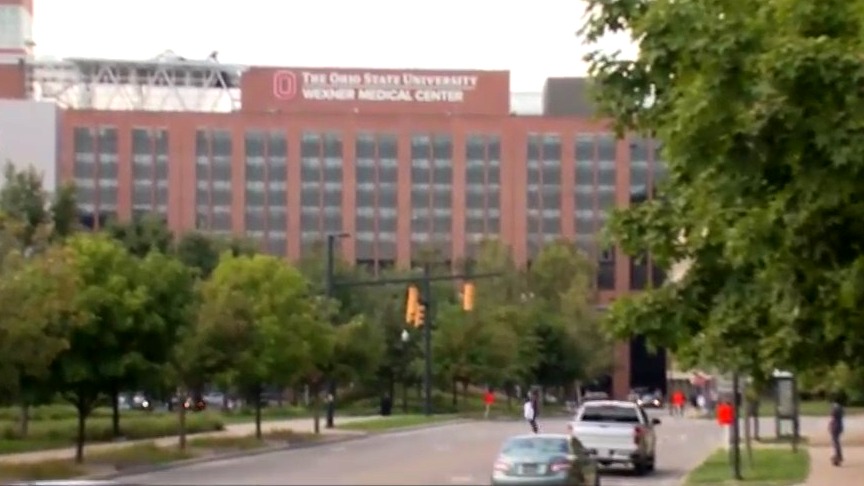 OSU Wexner makes history with new burn treatment