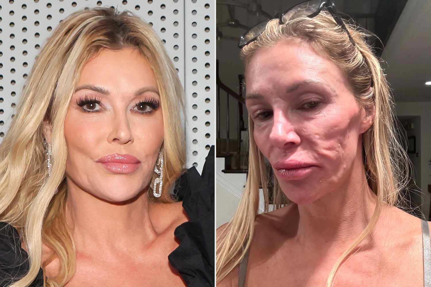 Brandi Glanville Steps Out for First Time Since Dissolving Her Face ...