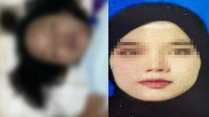 Terungkap Bekas di Tubuh ANF,Adik Tewas Diracun Kakak Ipar Pakai Jamu ... Terungkap Bekas di Tubuh ANF,Adik Tewas Diracun Kakak Ipar Pakai Jamu ...