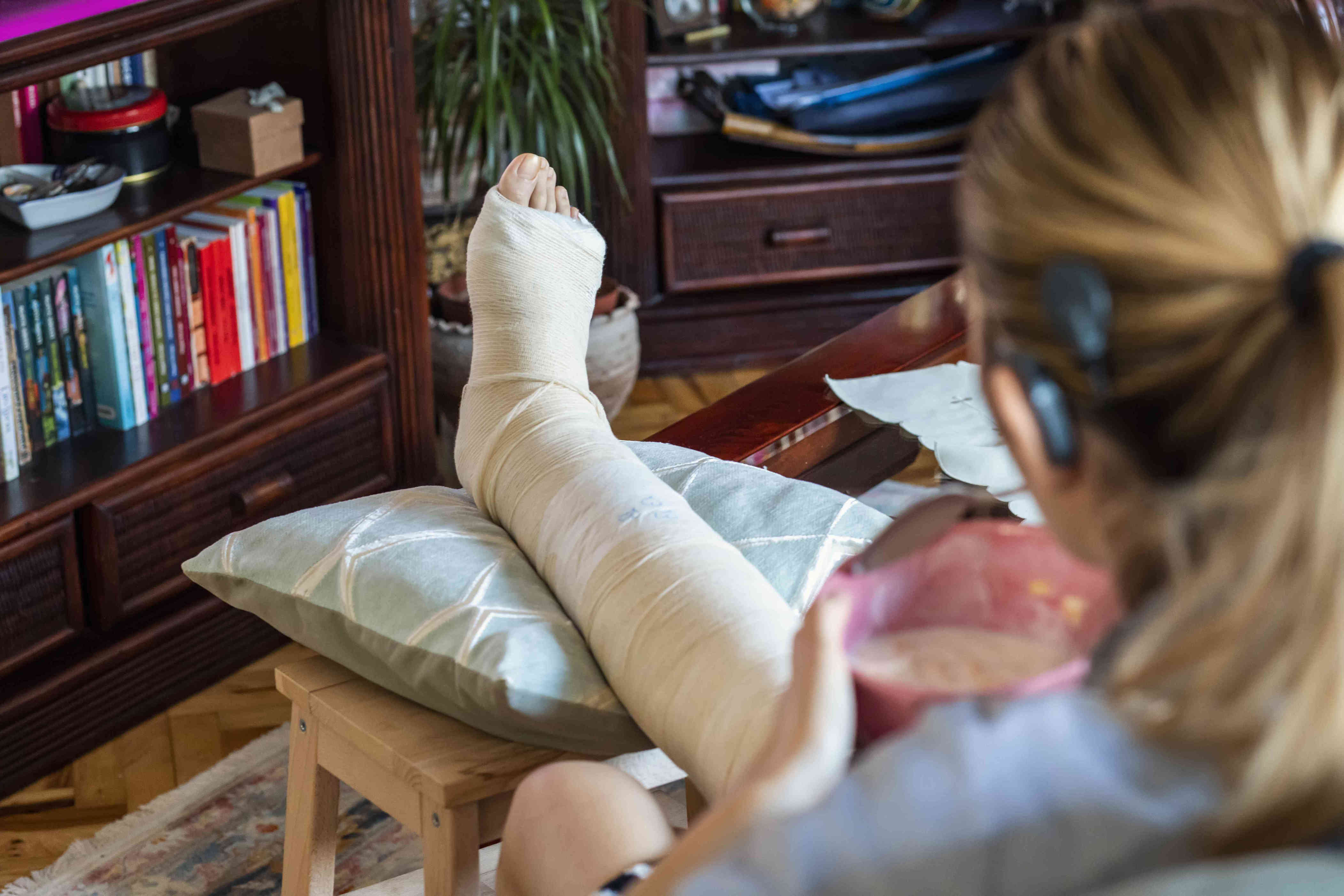 What To Know and Do About a Broken Leg