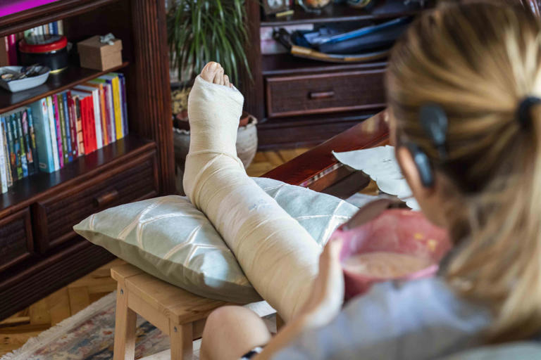 What To Know and Do About a Broken Leg