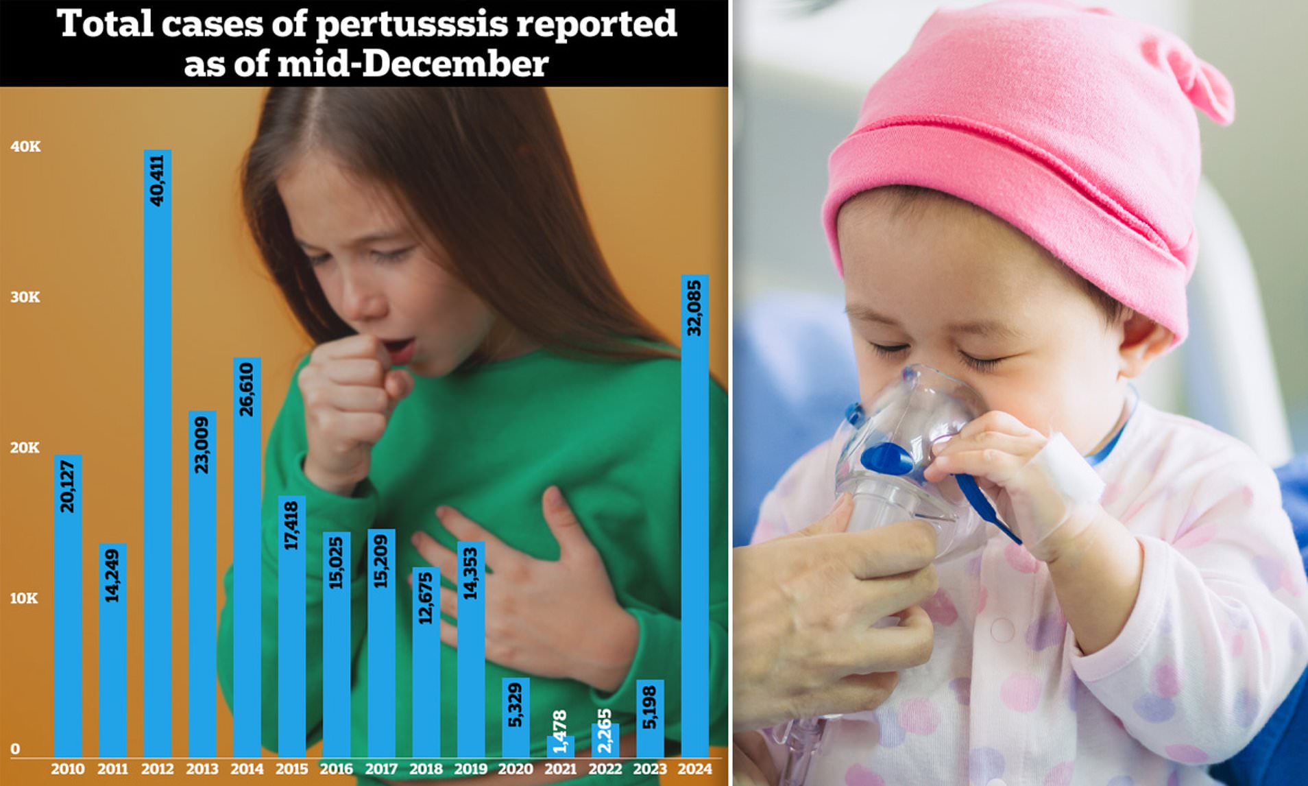 Cases of rib-cracking lung diseases surge to record highs across US