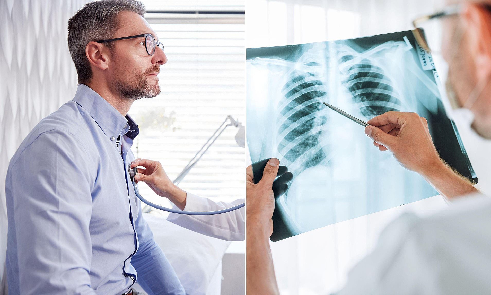 More people with lung cancer symptoms should self-refer for tests