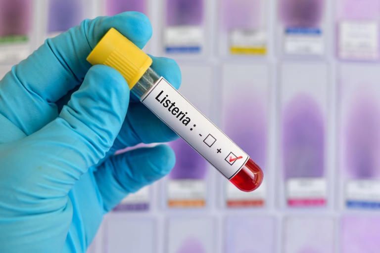 Qué es la listeria, la peligrosa bacteria detectada en dos productos en ...