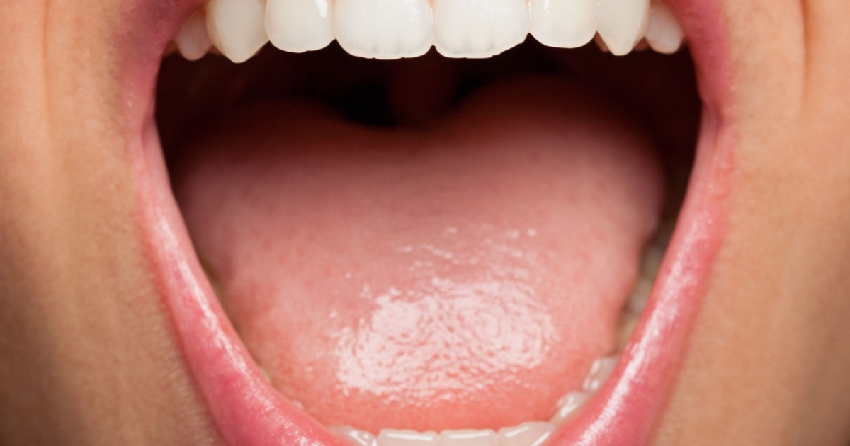 Was dein Mund über deine Gesundheit verrät