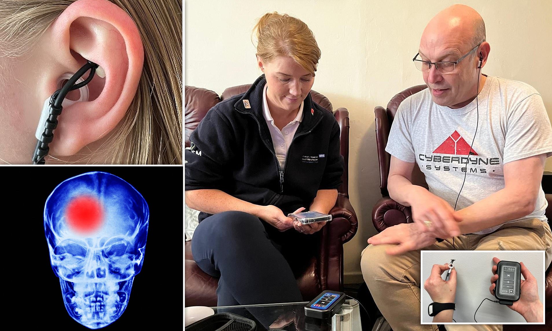 The zapper which could help stroke patients regain use of their arms