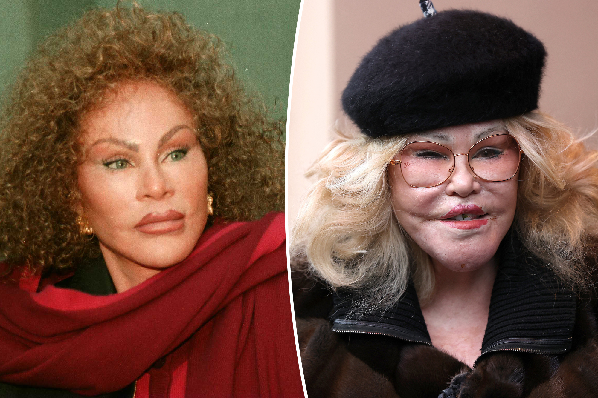 ‘Catwoman’ Jocelyn Wildenstein’s final resting place revealed — surgery ...