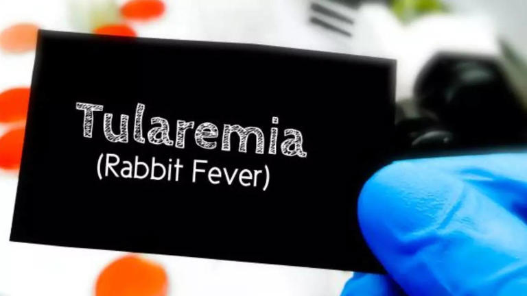 What Is Rabbit Fever or Tularaemia? Why Is There A Surge In Cases ...
