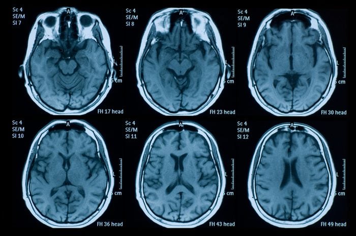 15 Things to Start Doing at 50 That’ll Save Your Brain at 80