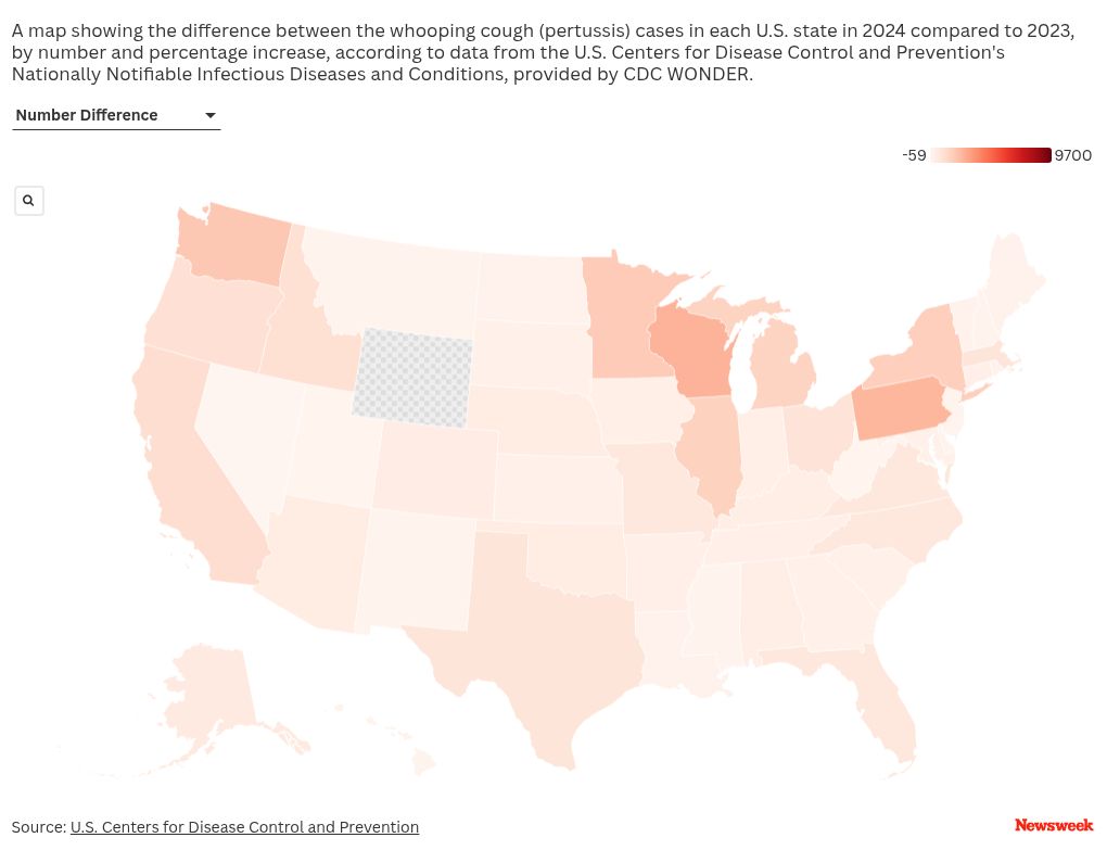 Map Reveals Where Whooping Cough Cases Soared Last Year
