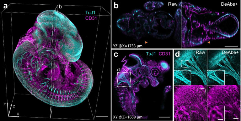 AI Revolutionizes Microscopy by Sharpening Deep Tissue Images