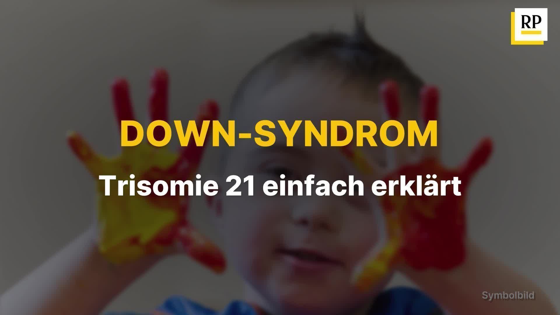 Down-Syndrom: Das sollten Sie zu Trisomie 21 wissen