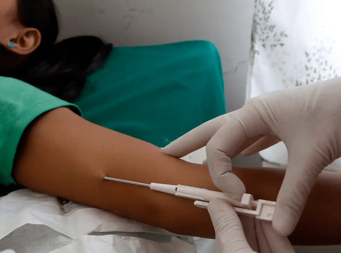 5 important things to know before getting a contraceptive implant