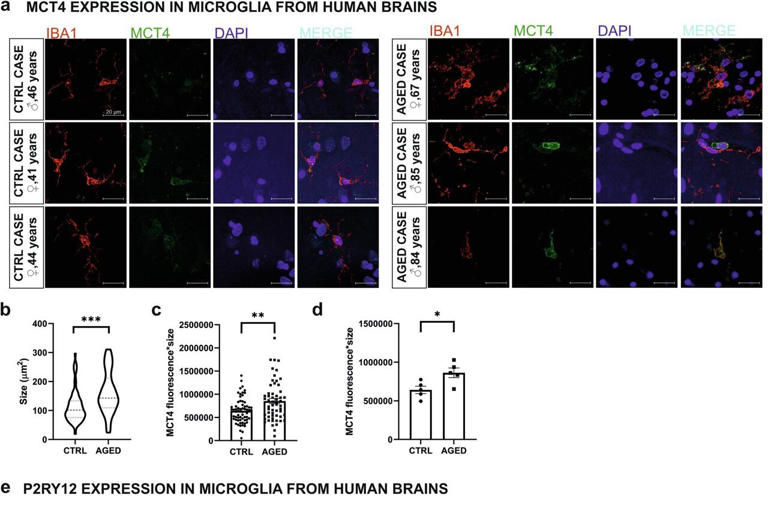 Aging brain cell microglia tied to neurological disorders