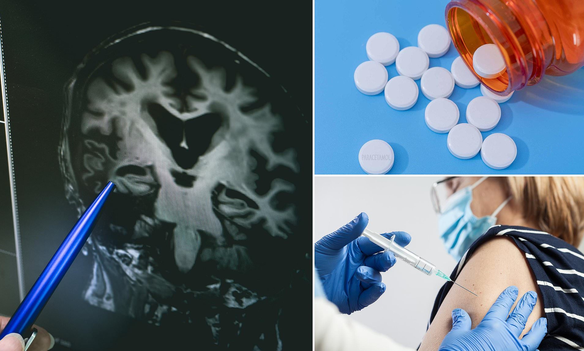 Experts pinpoint 5 common medications that could raise dementia risk