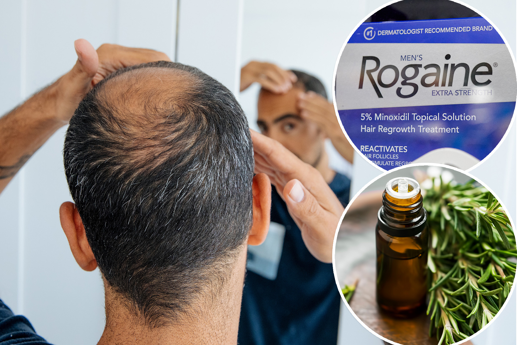 Rogaine and rosemary oil both fight hair loss — is it better when you ...