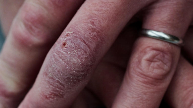 It's not just snow this week. Keep an eye on Indiana's bitter wind chills