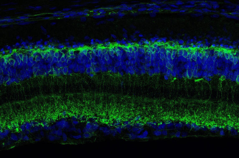Ziapin2 effectively restores retinal function in preclinical models of ...