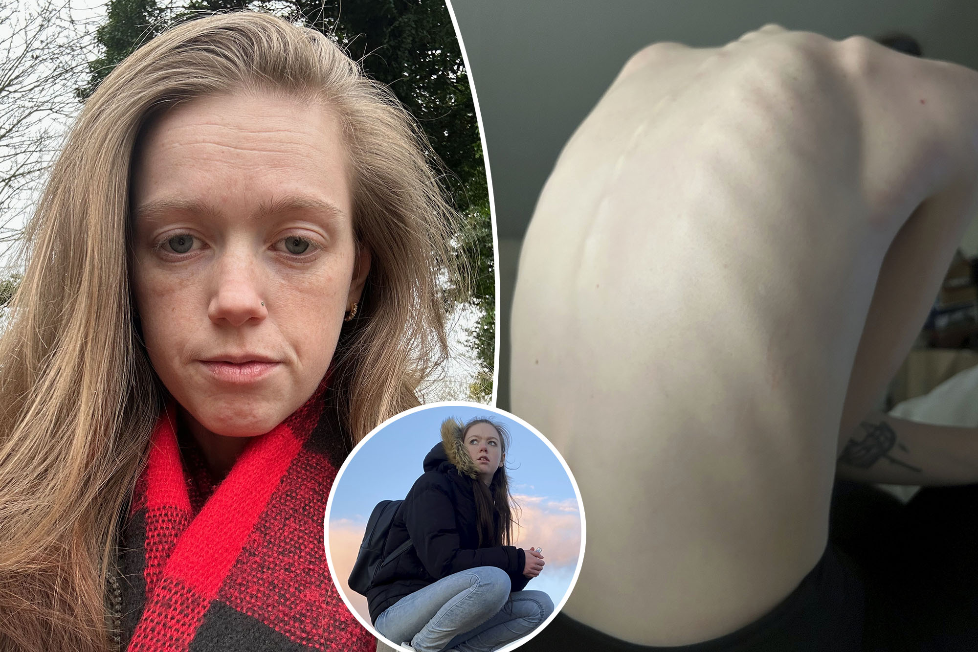 I have to stand to eat — or else I’ll choke from an extremely rare ...