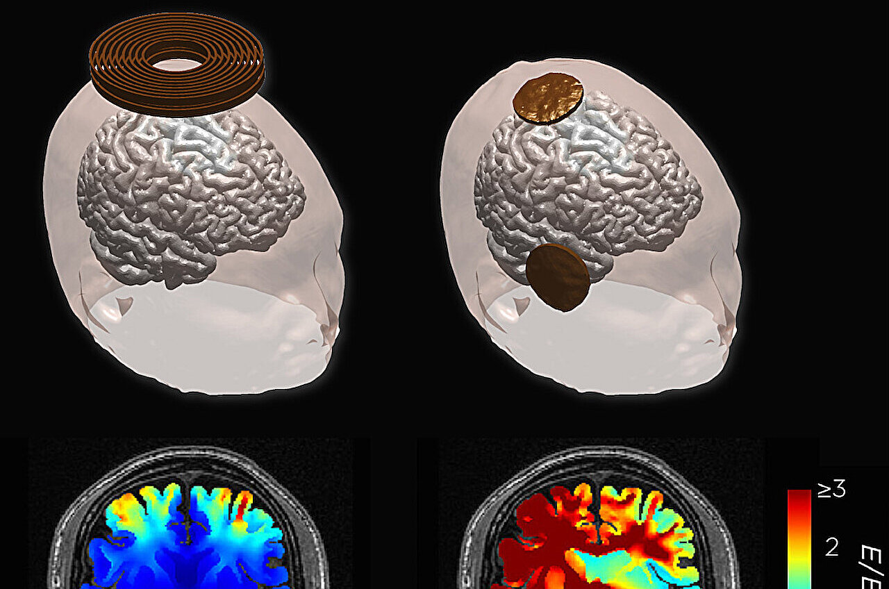 Innovative magnetic therapy for depression preserves cognitive ...