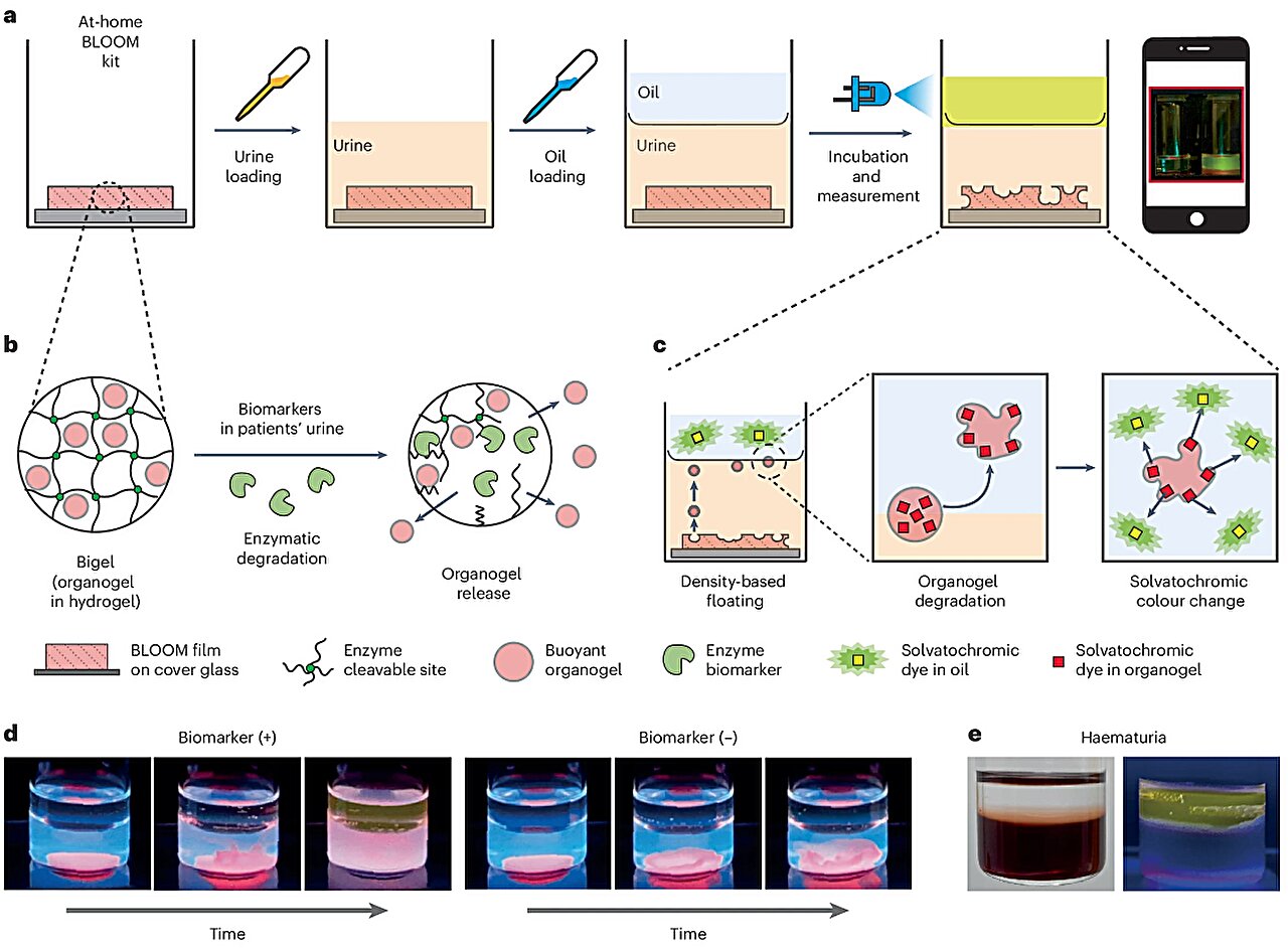 Urine-based bladder cancer diagnostic kit can be used at home