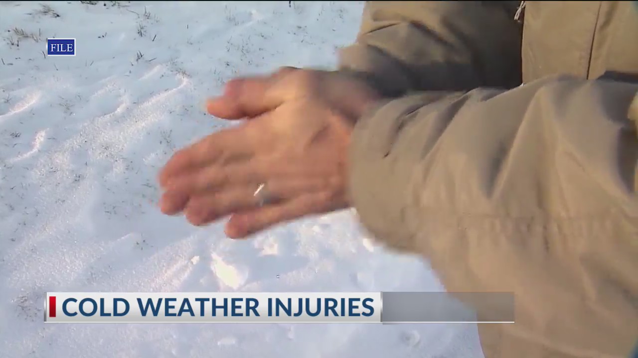 Dozens sent to ER for cold weather injuries