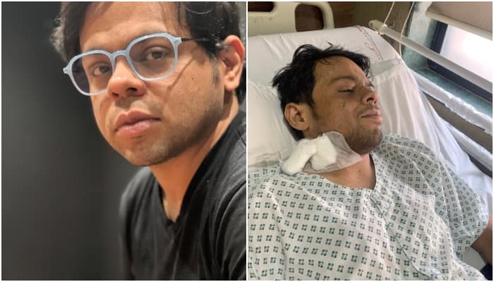 'Dunki' actor Varun Kulkarni seeks help amid severe health crisis; Check