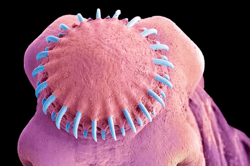 'Insane' X-ray shows bloke 'full of eggs' after doing one thing wrong ...