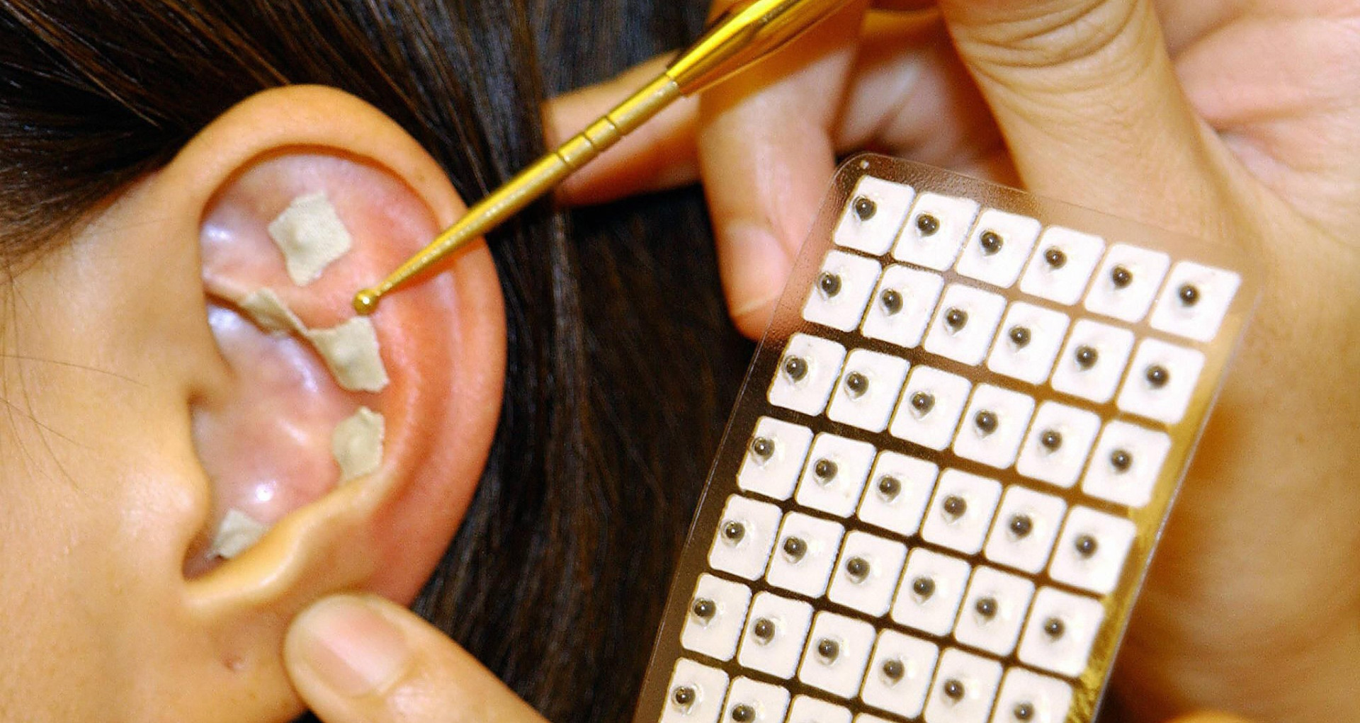 What are ear seeds, and how do they work?