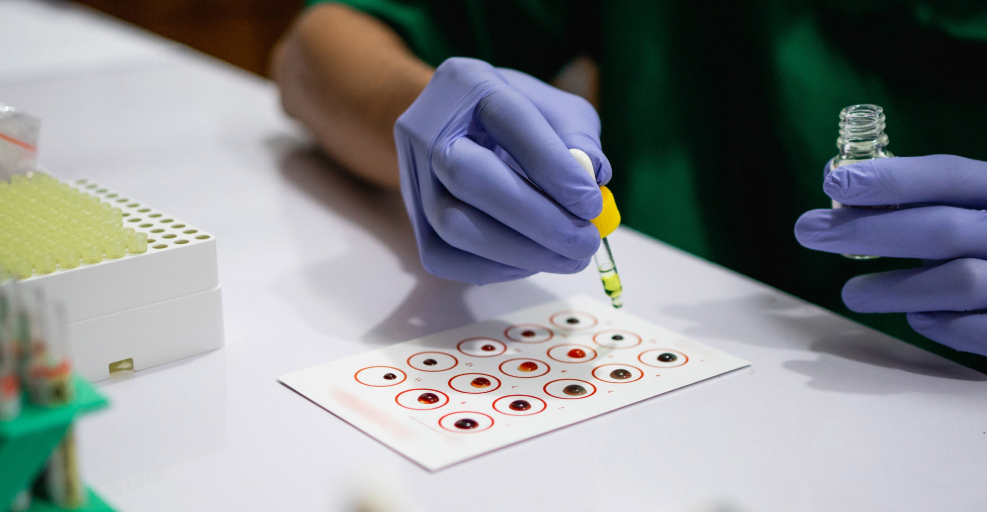 This is how your blood type can affect your health This is how your blood type can affect your health