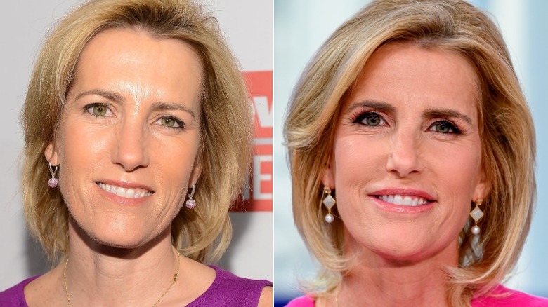 Plastic Surgeon Tells Us Laura Ingraham's Inability To Close Her Lips ...