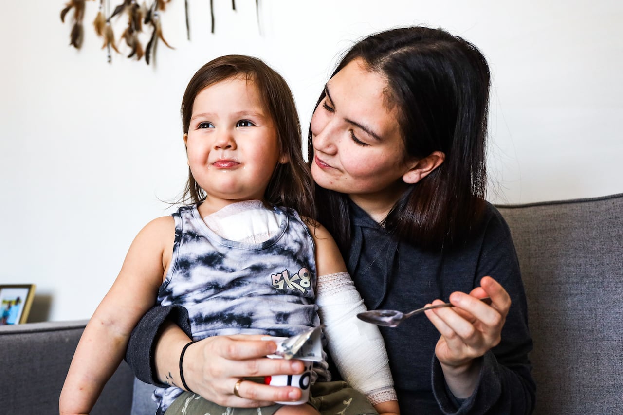 Manitoba mother wants answers after IV treatment leaves toddler with ...