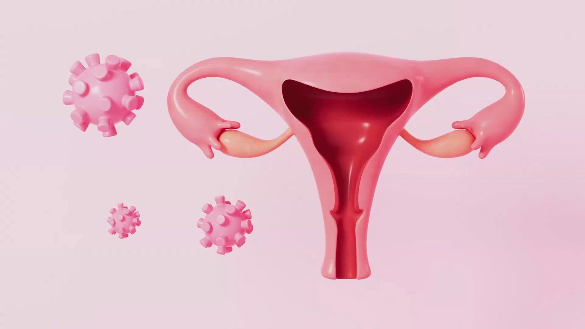 Ways to prevent cervical cancer Ways to prevent cervical cancer
