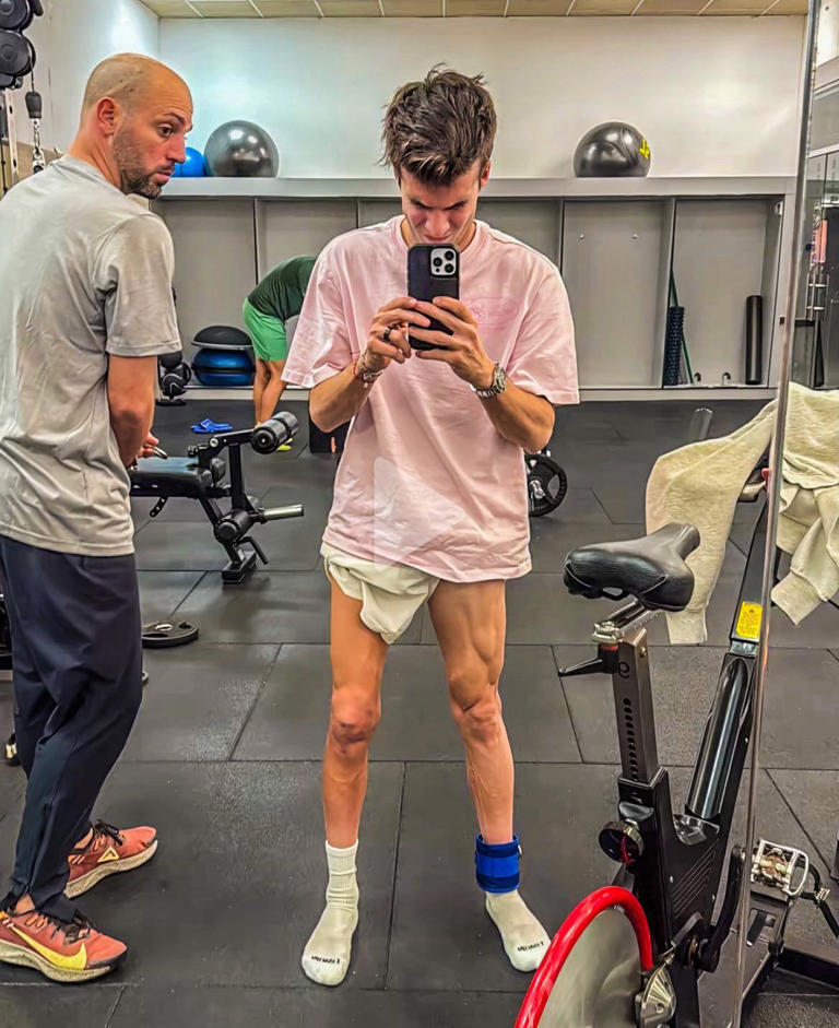 Riqui Puig mostra l’impressionante stato delle sue gambe dopo il grave ...