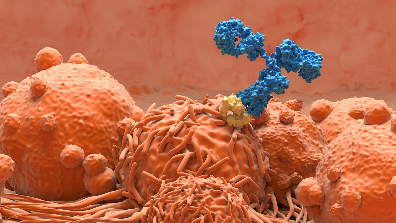 Anti-TIGIT Shows Promise in Unresectable Liver Cancer